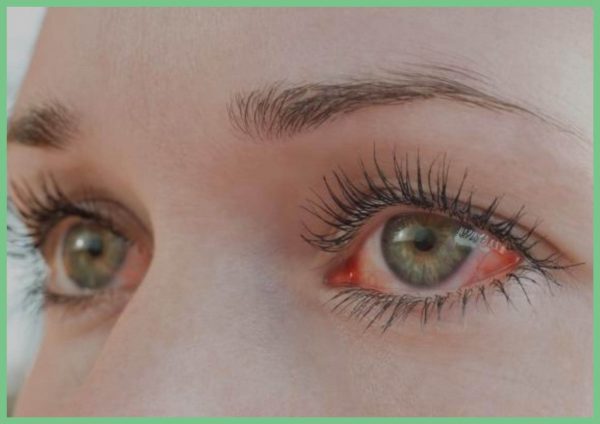 Cannabis Facts: Why Does Weed Make Your Eyes Red?